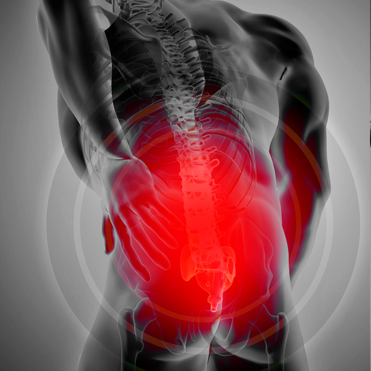 Low Back Pain NJSM